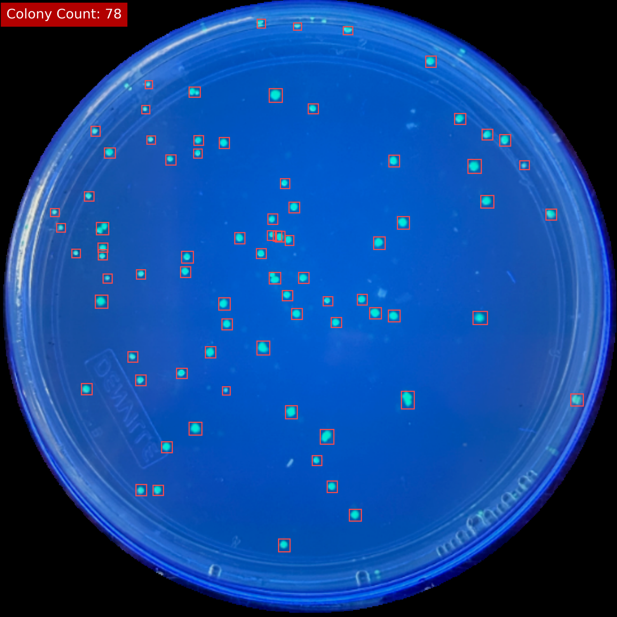 Beyond Manual Counting: How Our Colony Counter is Changing Lab Life ...